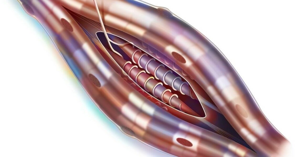Muskelspindeln: Funktion und Anatomie